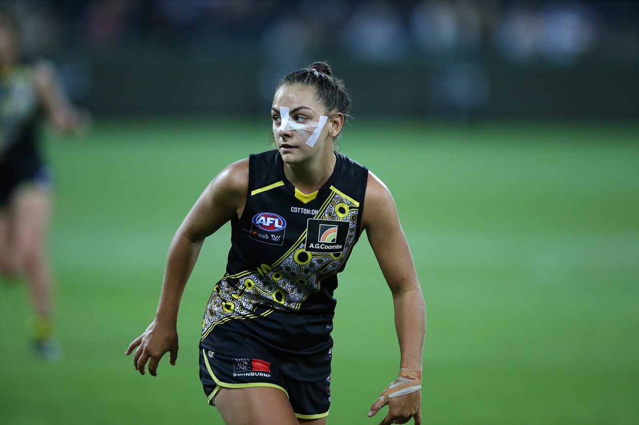 Conti out of Roos clash