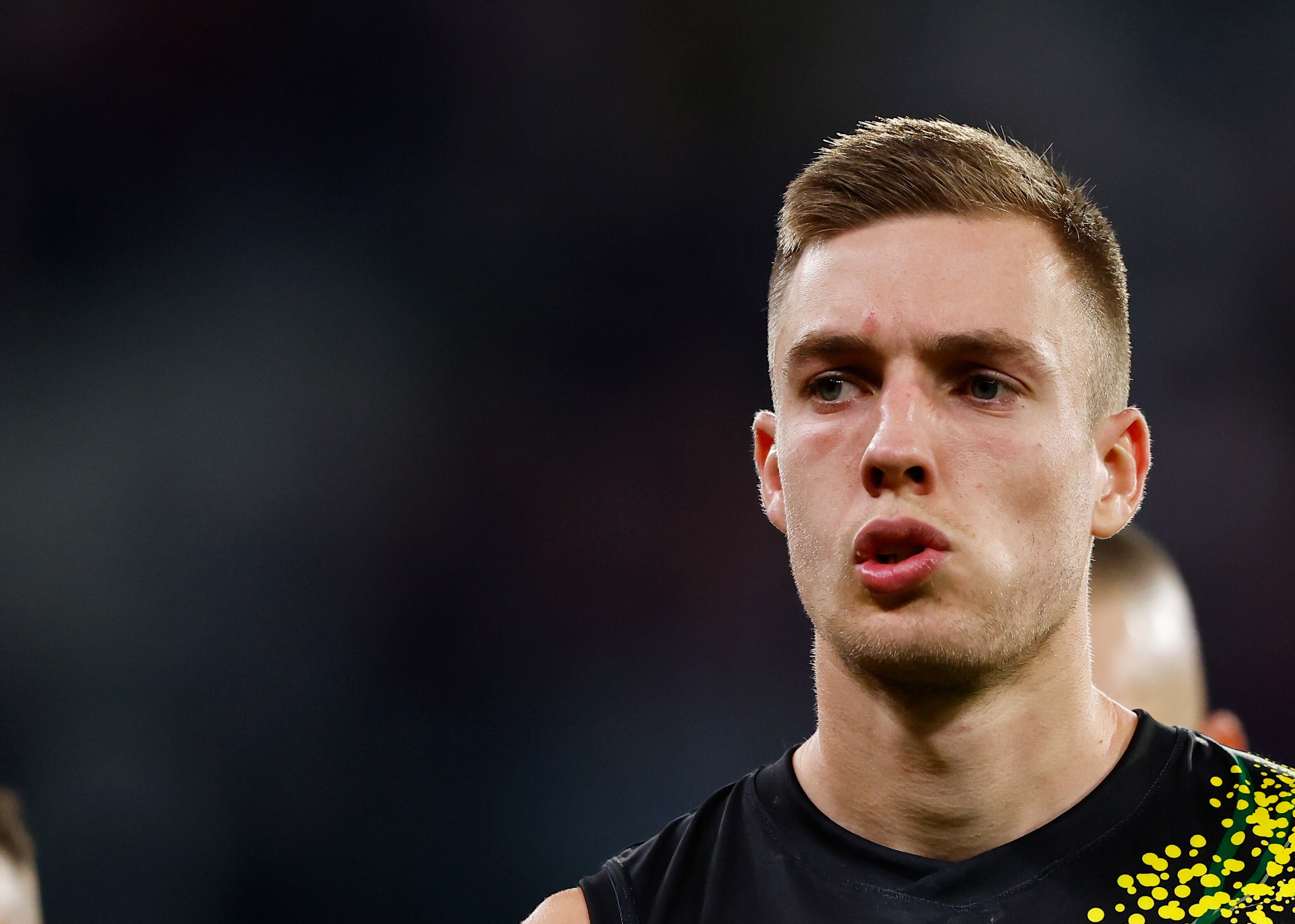 Tylar Young Injury Update