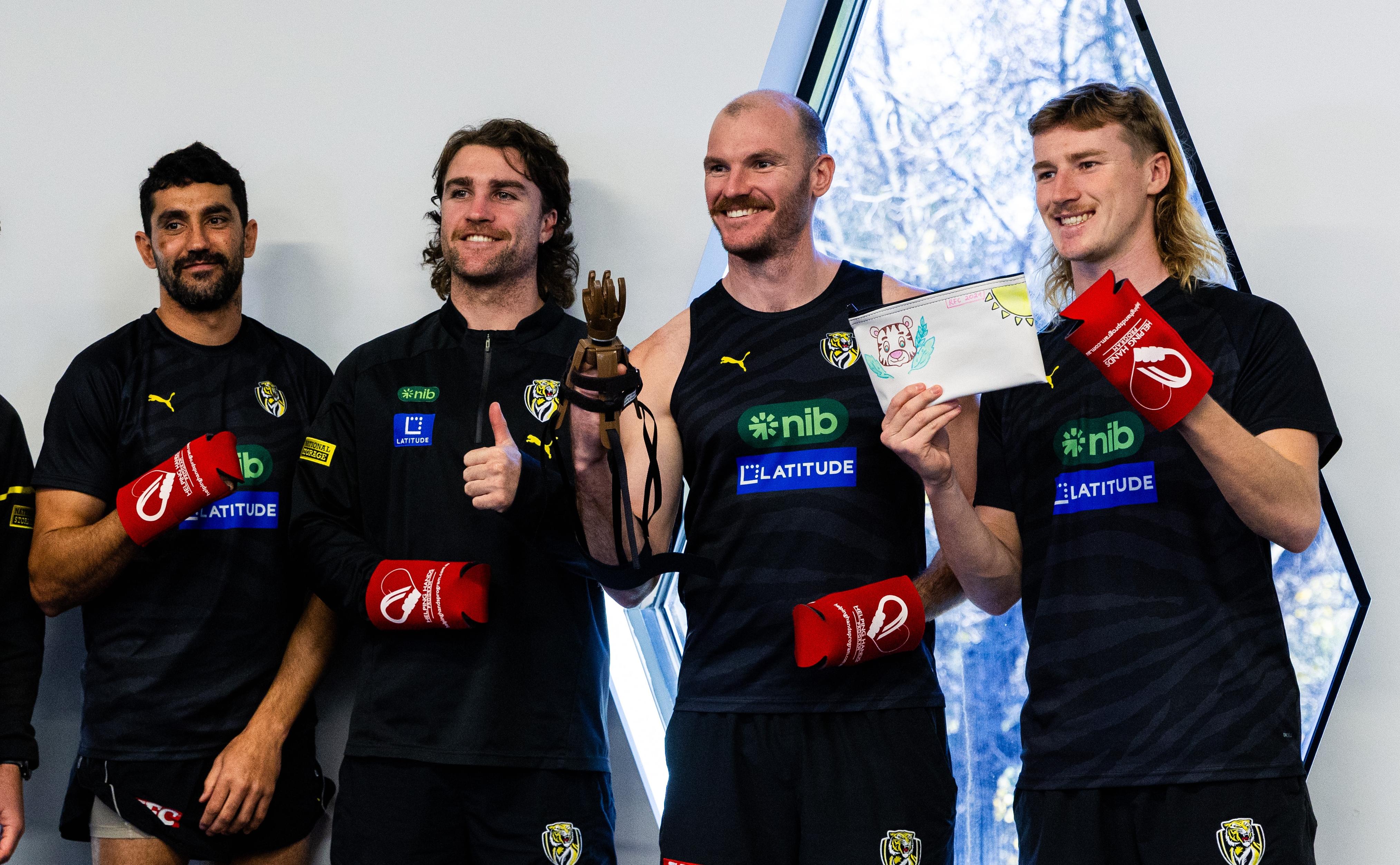 Tigers lend a hand to build prosthetic limbs for overseas recipients